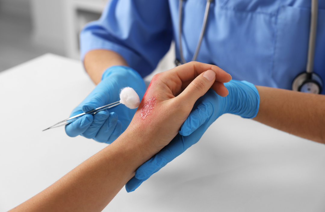 Pressure Ulcers and Moisture Lesions - CRT Care Services